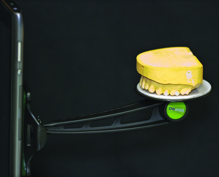 The Virtual Facebow: A digital companion to implantology