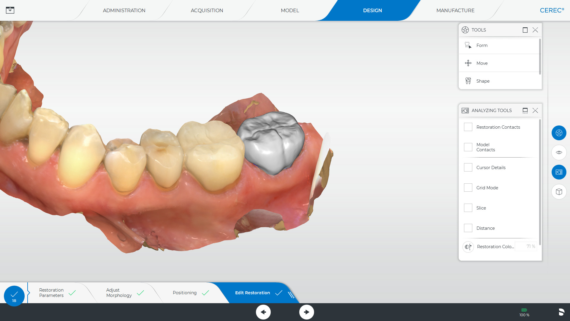 Dental News - Scan perfectly with CEREC Primescan and gain time for ...