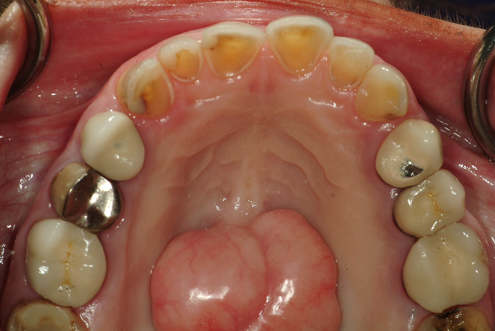 Dental News - Occlusion principles for the practising dentist in the ...