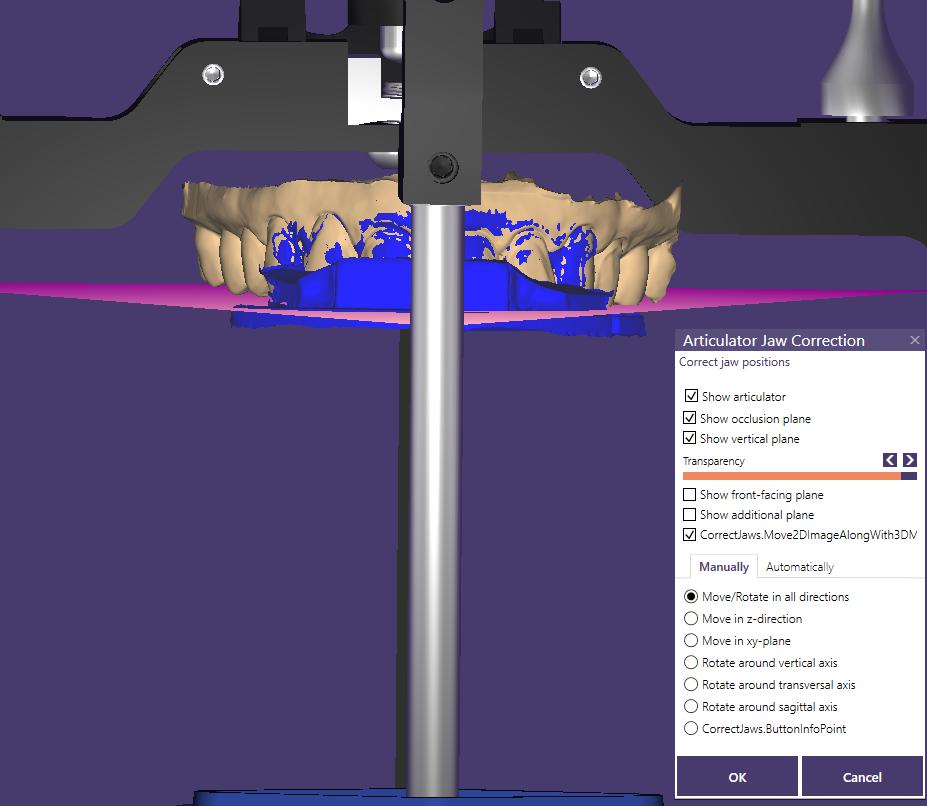 Digital face-bow transfer technique dentofacial analyser for dental ...