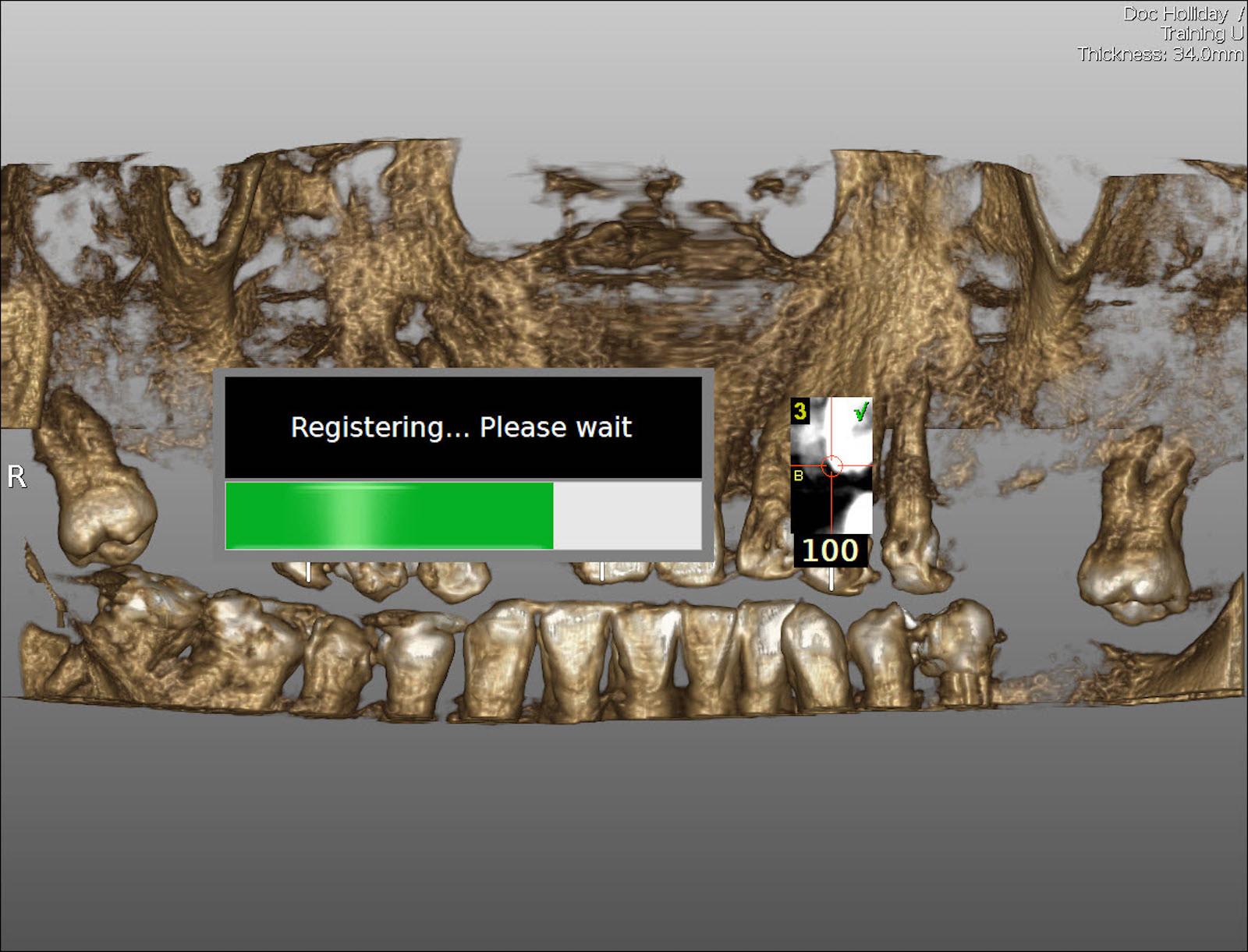 Dental News - Dynamic navigation—The future of minimally invasive ...