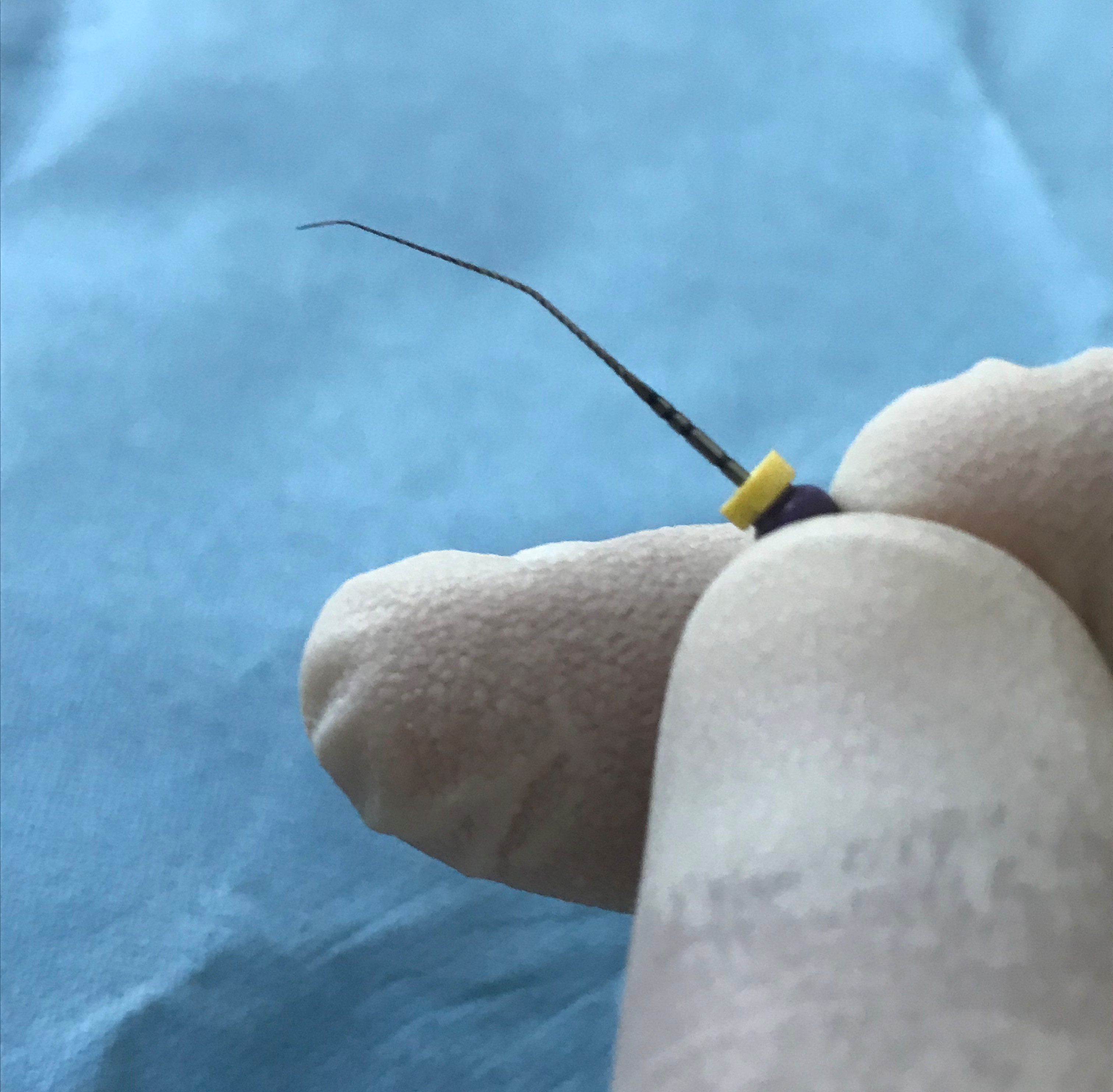 Dental News - Shaping a Type V mandibular premolar with VDW.ROTATE