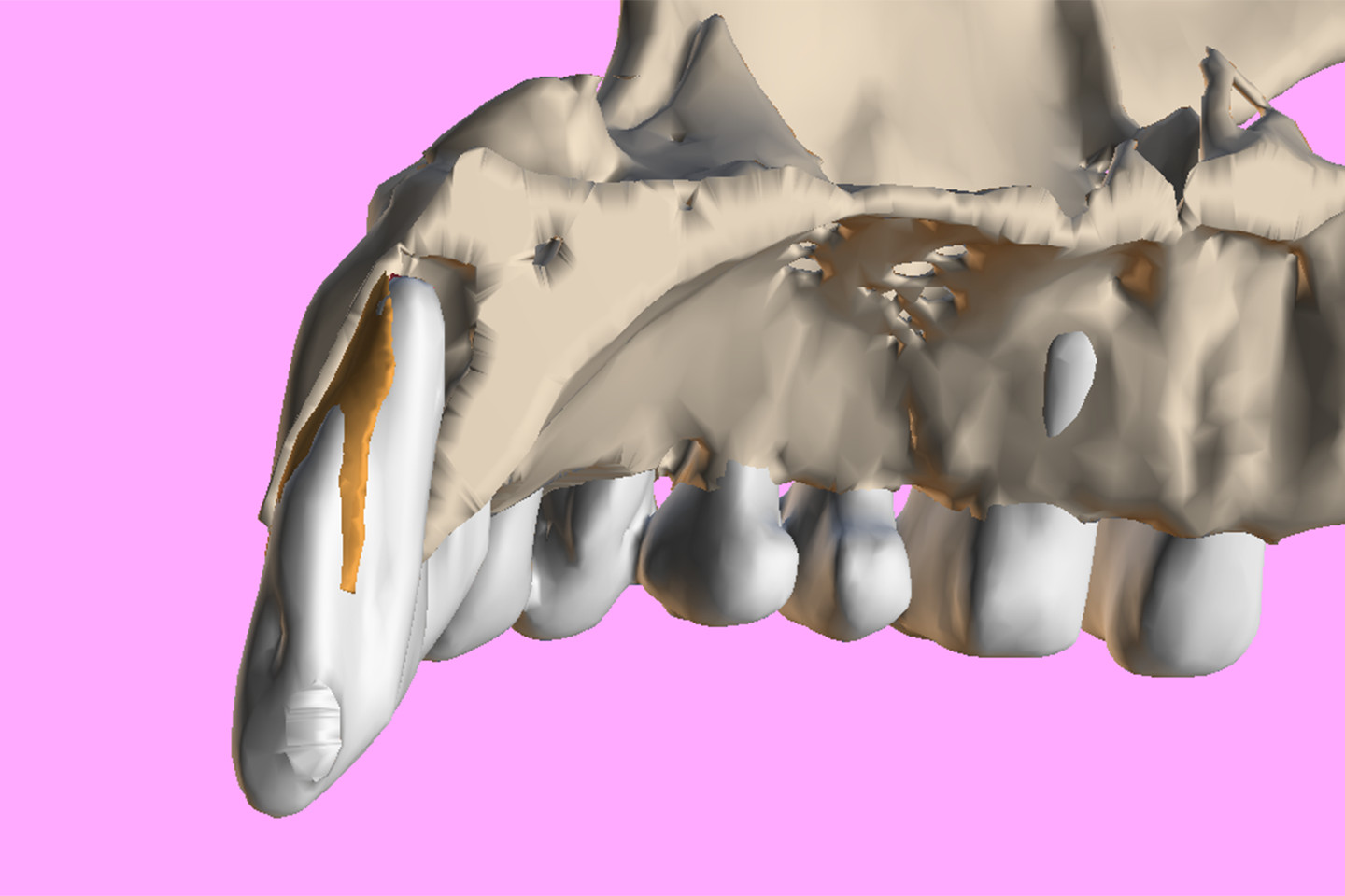 Dental News - Guided applications for partial extraction therapy
