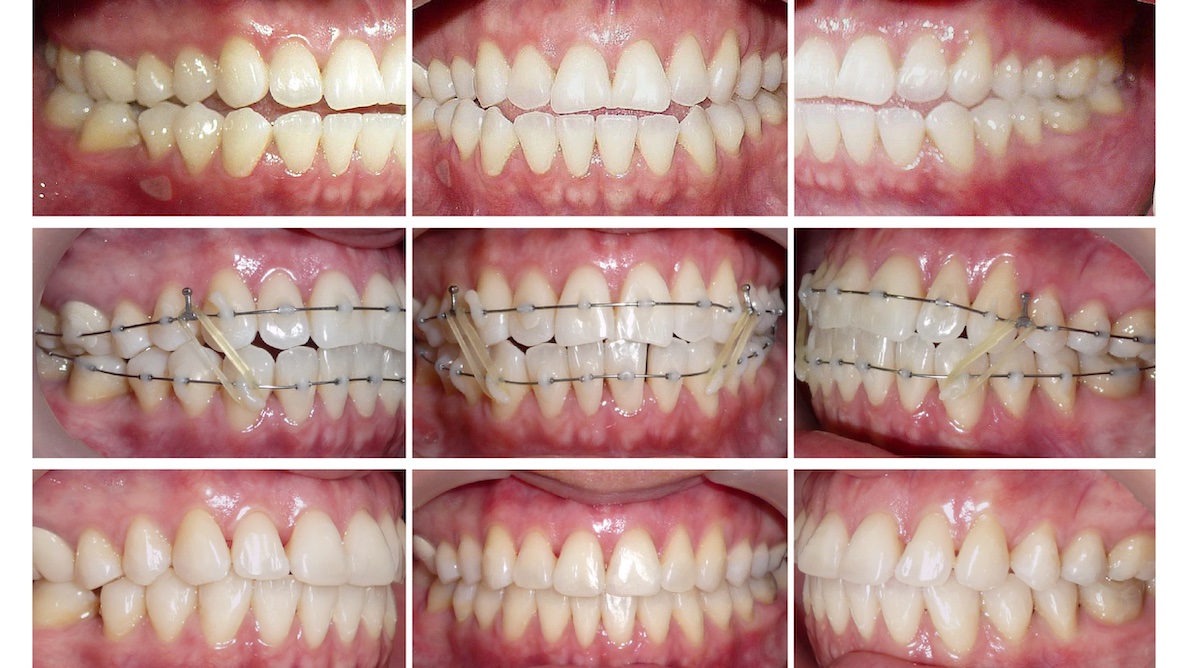 DT News - Latin America - Un sistema que revoluciona la biomecánica en ...