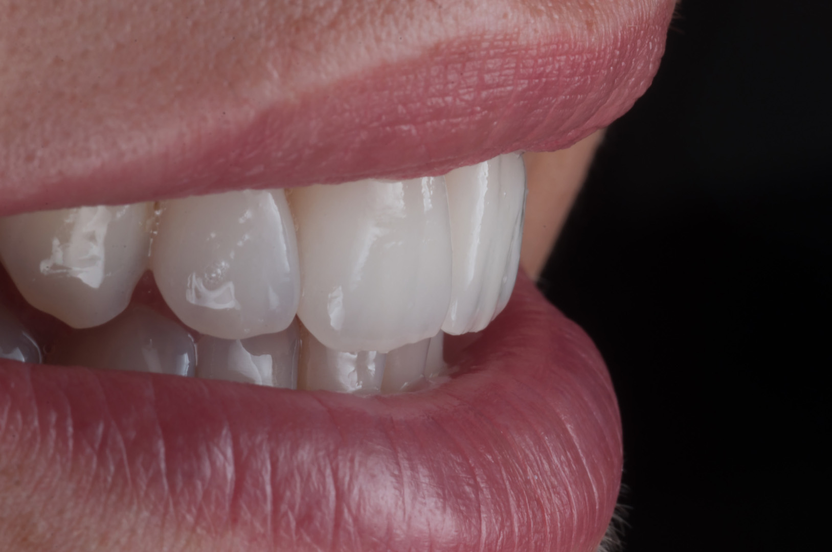 Surface texture: Using horizontal and vertical lines to simulate ...