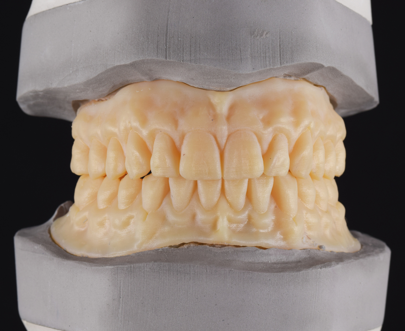 Production of complete maxillary and mandibular dentures using CAD/CAM ...