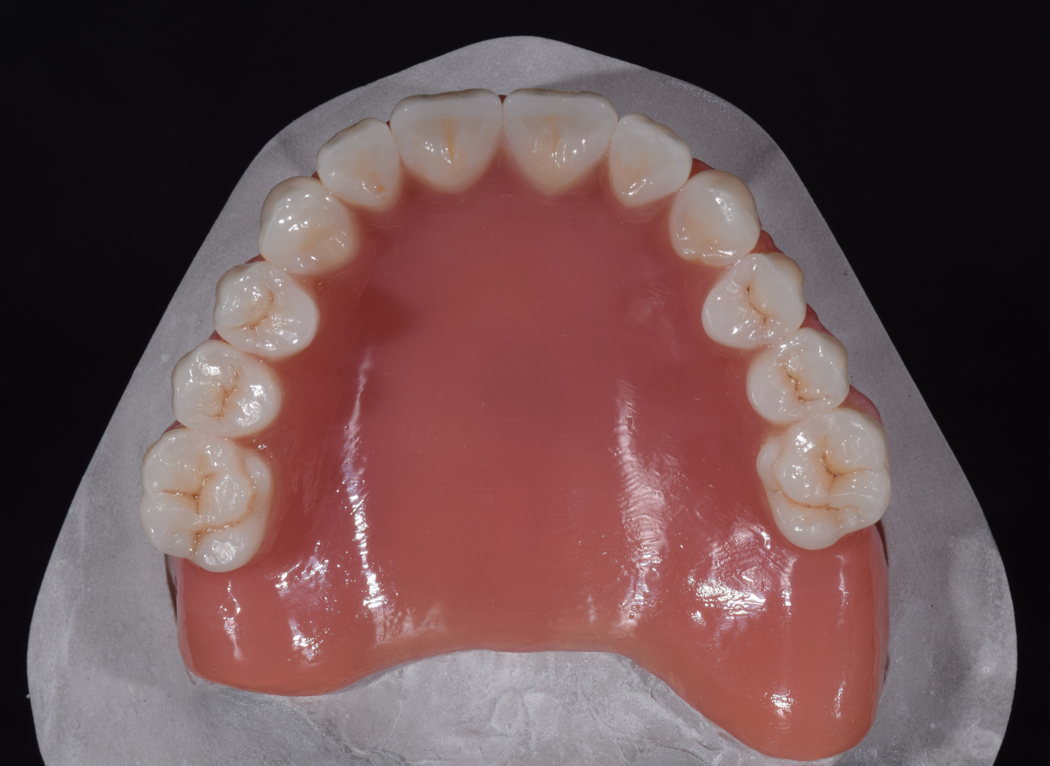 Production of complete maxillary and mandibular dentures using CAD/CAM ...