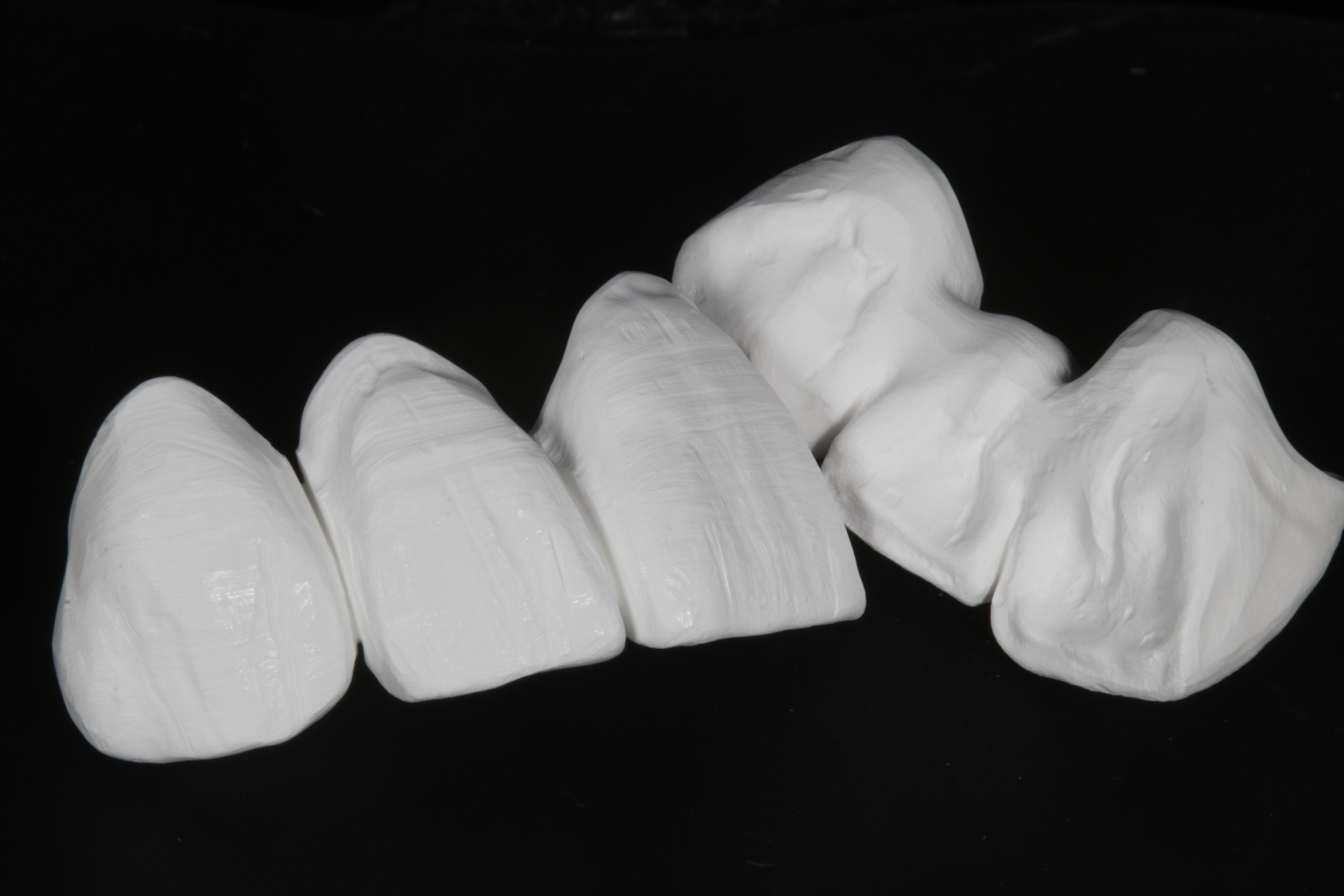 The zirconia dream team: Effect liquids and micro-layering