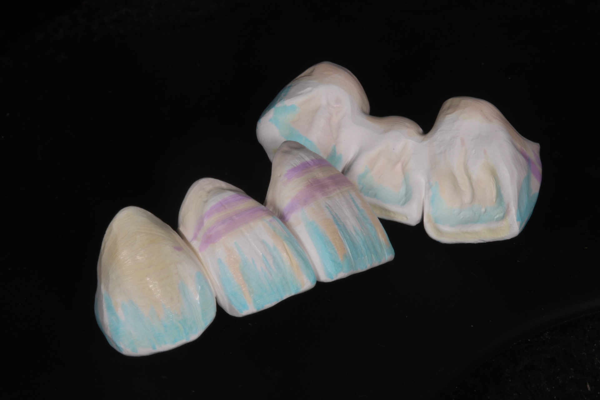 The zirconia dream team: Effect liquids and micro-layering