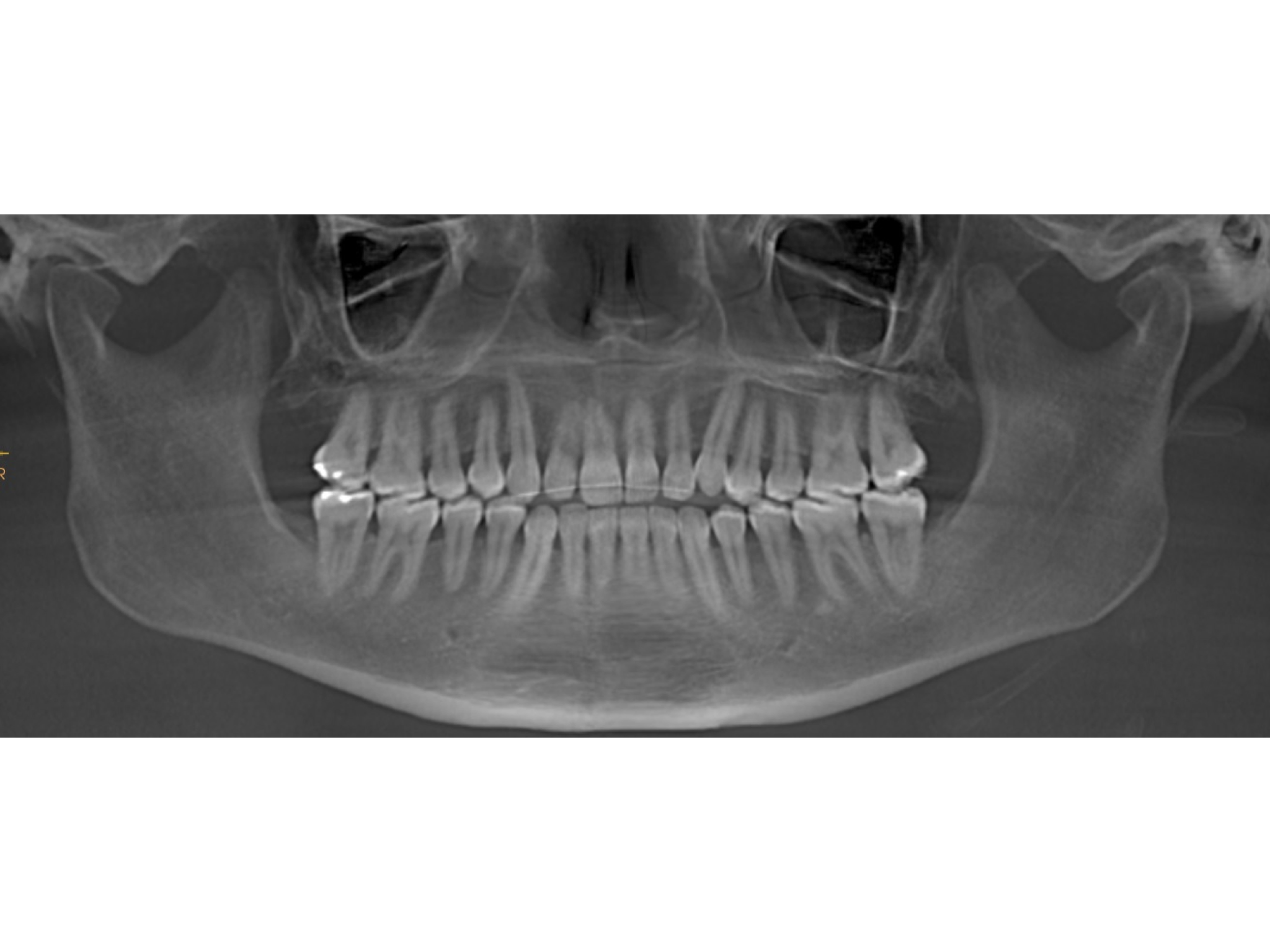The FAS Aligner System