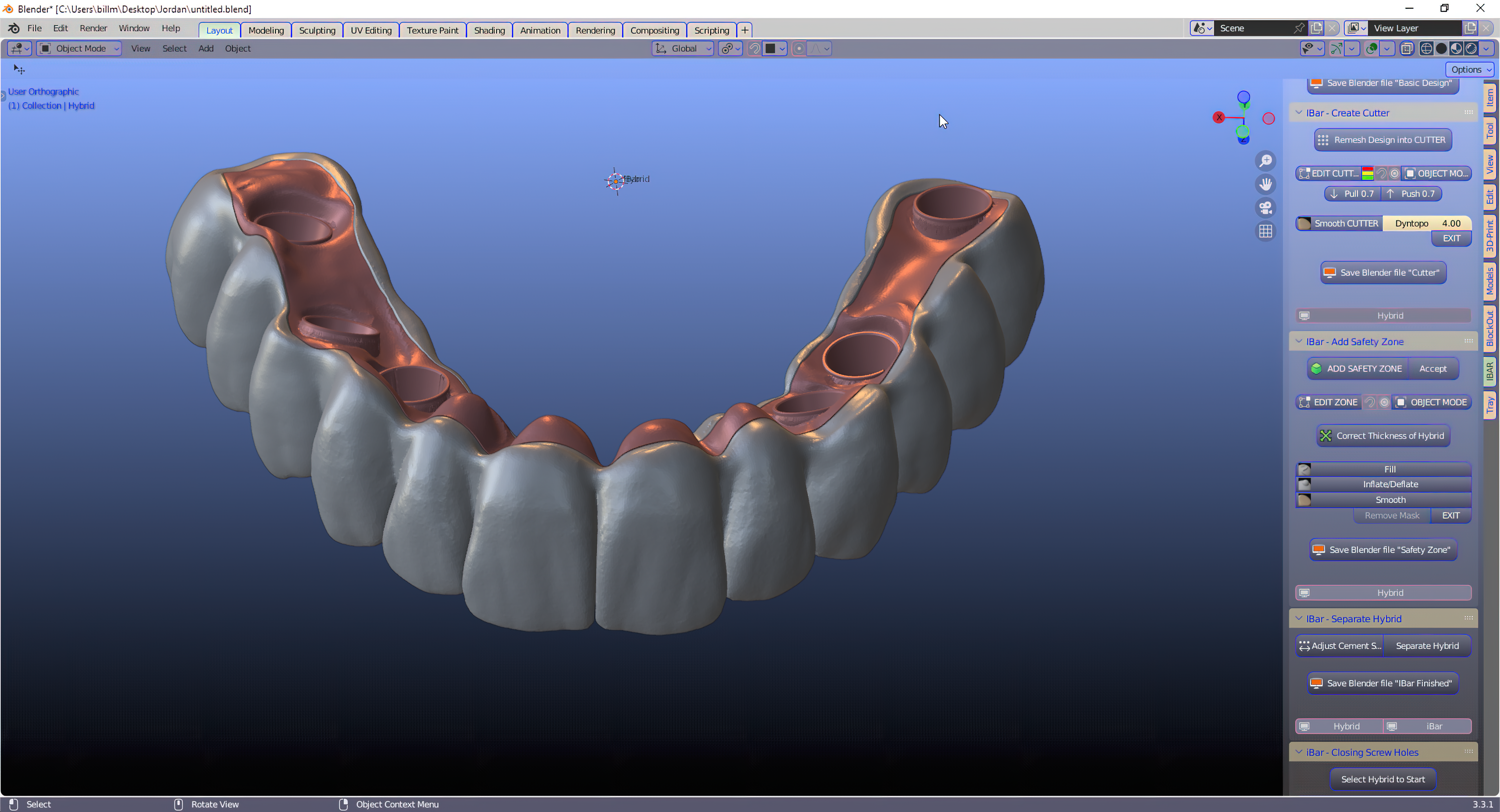 Dental News - Fabrication of a long-term prototype to develop and ...