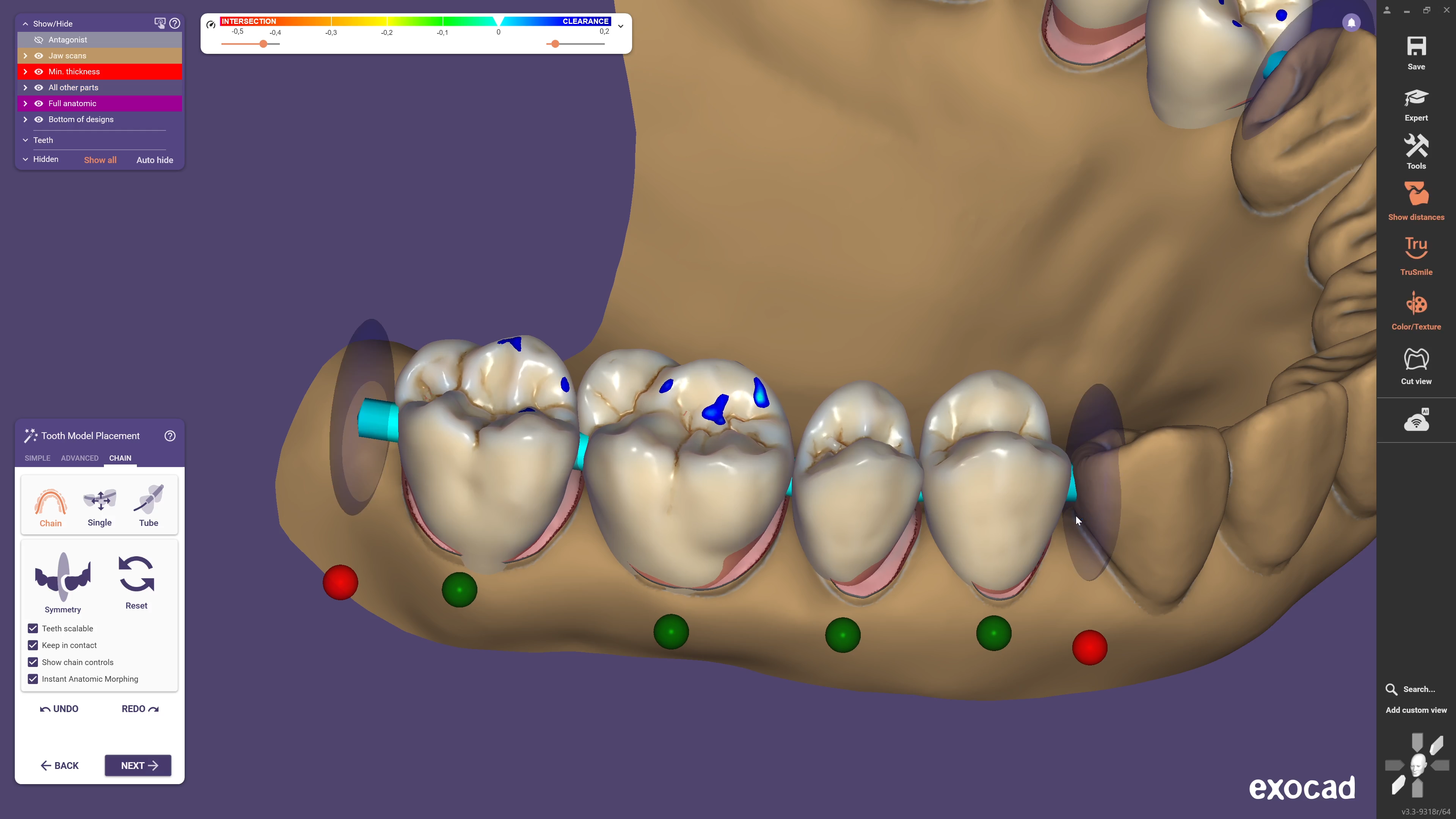 Exocad launches DentalCAD 3.3 Chemnitz